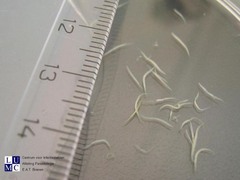 OXIÚRUS | Enterobius vermicularis » MD.Saúde